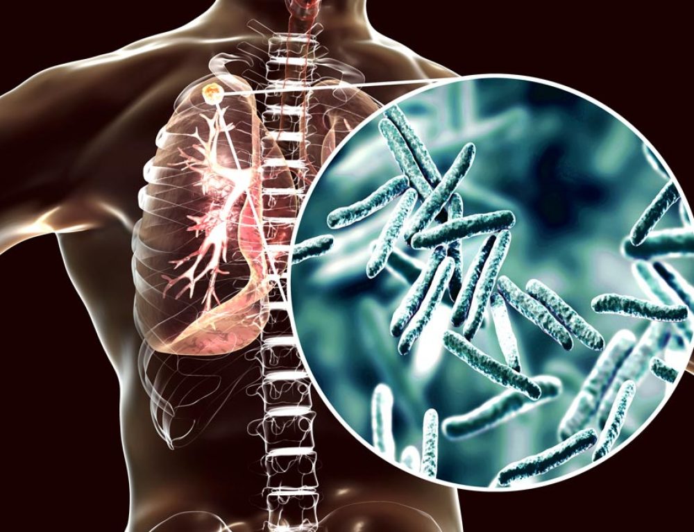 La tos es un mecanismo de defensa de los pulmones - Instituto de ...